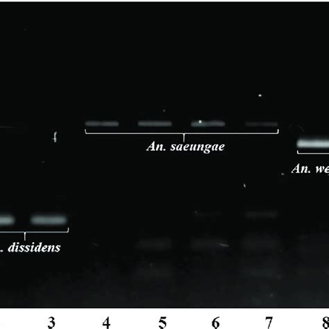 Pcr Product From The Multiplex Pcr Assay On A 2 Agarose Gel For