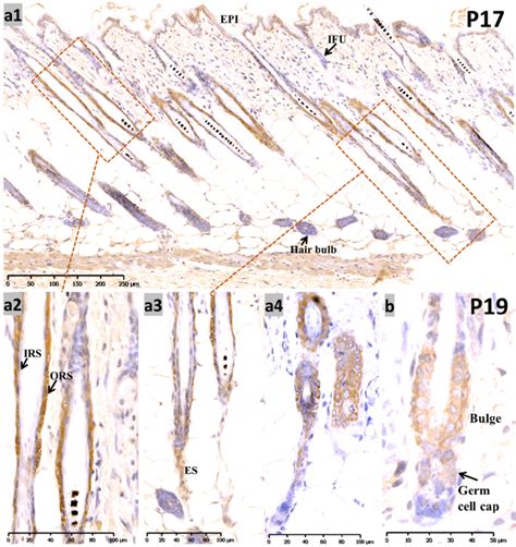 Expression Of Sox10 At P17 And P19 Postnatal Catagen And Telogen Of