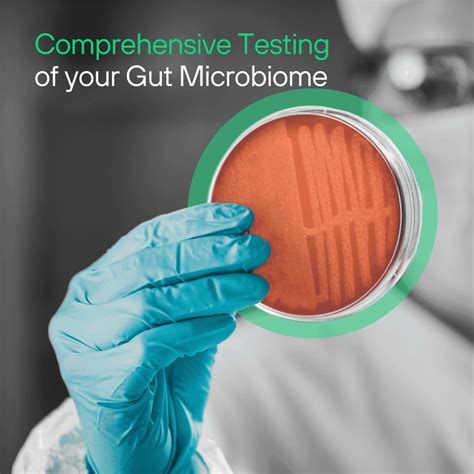 Gut Microbiome Test 30 Lifestyle Disease Sova Health