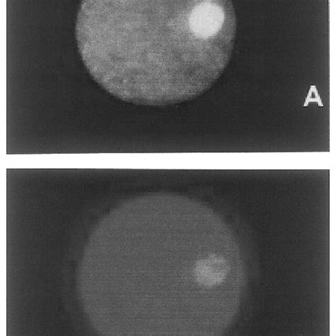 Representative Of Gv Stage Of Porcine Oocytes With Dna Fragmentation