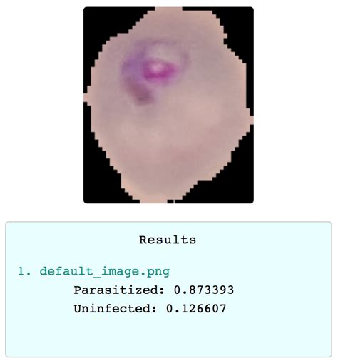 github vbookshelf malaria cell analyzer ai powered web app to