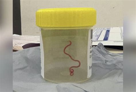 Australian Scientists Make World First Discovery Of Parasitic Worm In