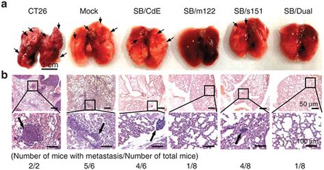 Gross And Microscopic Views Of Metastatic Nodules In Nude Mice A