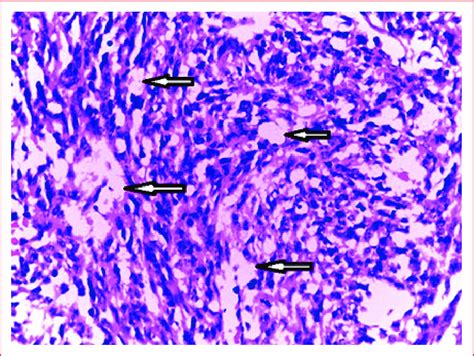 Gist G X 300 Coloration He Détail Au Fort Grossissement De Download Scientific Diagram