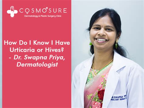 How Do I Know I Have Urticaria Or Hives Cosmosure Clinic
