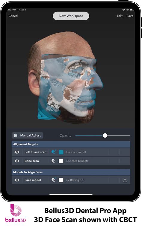 Bellus3D Announces Dental Pro 3D Face Scanning App