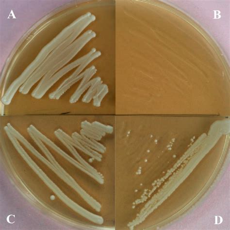functional complementation for the growth of the yeast strain ysc6274