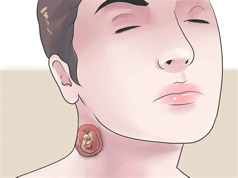 Nódulo No Pescoço Afinal O Que Pode Ser Saúde Blog Opas