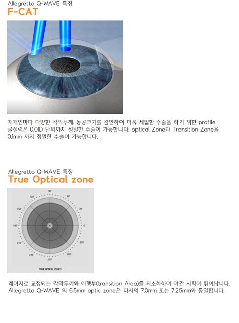 서울아이비안과