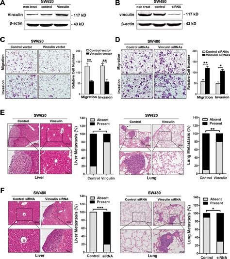 Vinculin Suppresses Crc Cell Invasion And Metastasis In Vitro And In