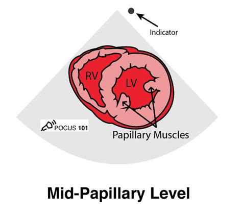 Cardiac Ultrasound Echocardiography Made Easy Step By Step Guide