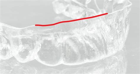 Ortho Retainers Dynaflex