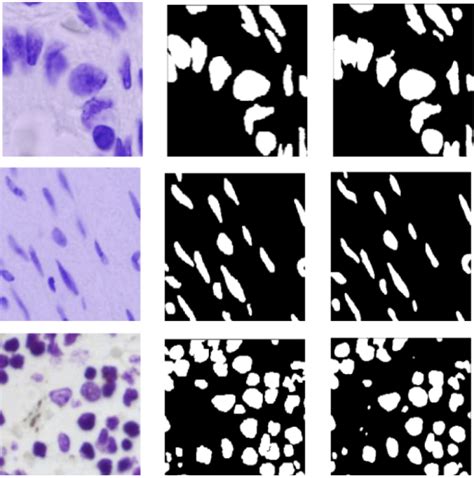 Medical Image Segmentation With IMerit Radiology Editor IMerit