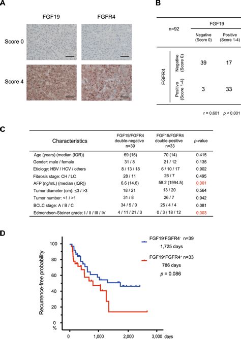 Fgf19fgfr4 Expression In Hcc Surgical Samples A Representative
