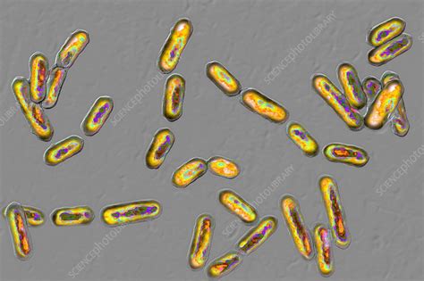 Clostridioides Difficile Light Micrograph Stock Image C Science Photo Library