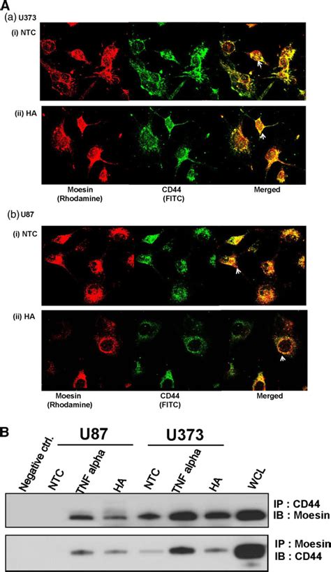HA Treatment Induces CD44 Moesin Interaction A Both U373 And U87