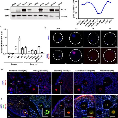 PDF Maternal NAT10 Orchestrates Oocyte Meiotic Cell Cycle Progression