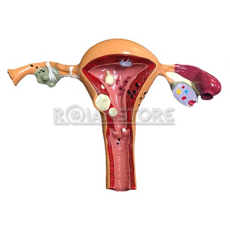 Roian Cl