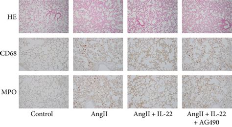 Il 22 Induced Obvious Inhibition Of Ali Induced By Angii A All Mice