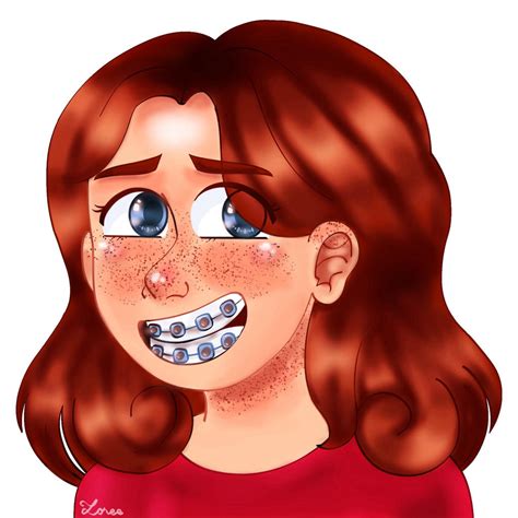 Braces By Ljracho On Deviantart Braces By Ljracho On Deviantart