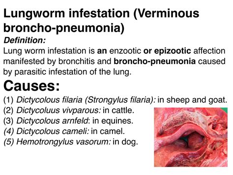 7 Aspiration Pneumonia Pdf