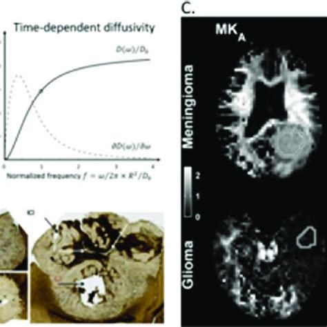 Dedicated Modeling For Tumor Microstructure A Electron Microscopy Download Scientific Diagram