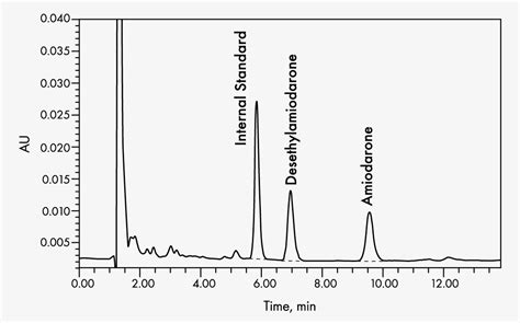 Amiodarone And Desethylamiodarone In Serum Plasma Hplc