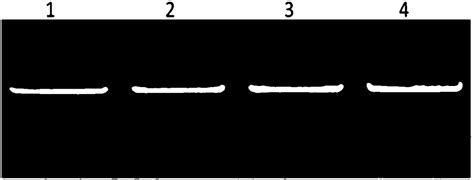 Method For Detecting Single Nucleotide Polymorphism Of Sex Determining Region On Y Chromosome