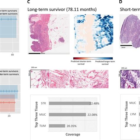 Quantitative Histopathology Imaging Predicts Stage I And Ii Colorectal