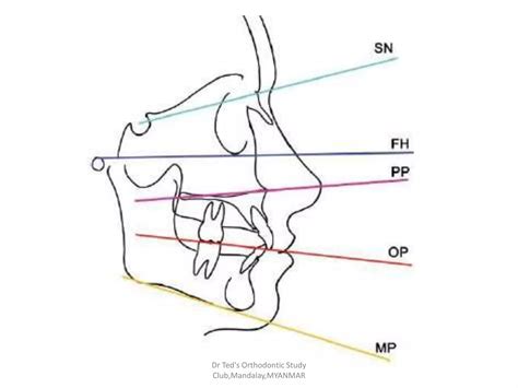Practical Cephalometric Tracing Pptx