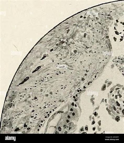 Gynaecology For Students And Practitioners Fro 291 Transverse
