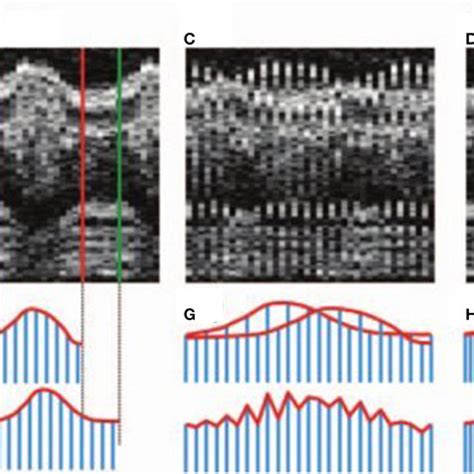 Illustration Of Sequence Alignment By String Length Minimization Upper