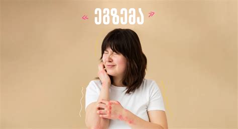 ეგზემა როგორ ამოვიცნოთ ის