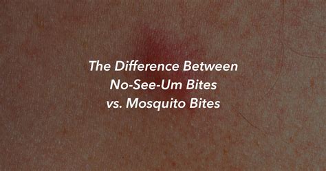 The Difference Between No See Um Bites Vs Mosquito Bites The