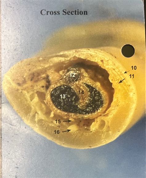 Worm Cross Section 2 Diagram Diagram Quizlet