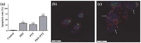 A Photosensitizer Loaded Polydopamine Nanomedicine Agent For