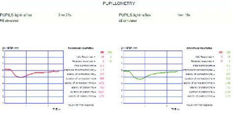 Pupillary Light Reflex Responses Recorded By Dynamic Pupillometry In A Download Scientific