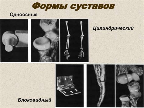 Опорно двигательная система презентация онлайн