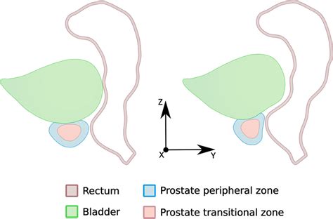 Profiles Of The Prostate Transitional Zone Tz Prostate Peripheral