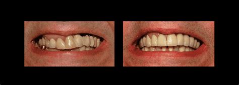Smile Gallery Exton Dentist
