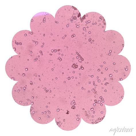 Light Microscope Of Calcium Oxalate Crystals Are Shaped Like Wall Mural • Murals Acid Science