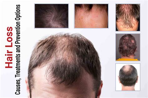 Itchy Scalp And Hair Loss Causes Treatments And Prevention Options