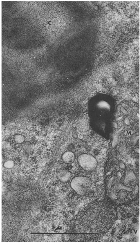 Figure 1 From Structural Aspects Of Saltatory Particle Movement Semantic Scholar