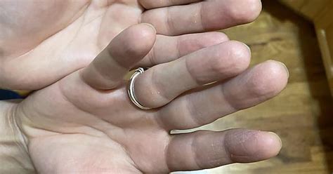 Weird Hands Album On Imgur