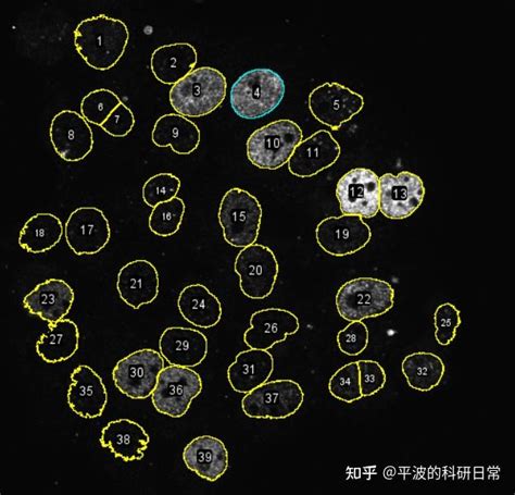 Imagej——荧光图片中单个细胞荧光强度测量 知乎