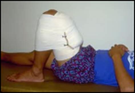 Samarpan Physiotherapy Clinic Myositis Ossificans And Physiotherapy