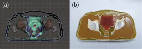A The Front Of The Phantom Computer Modeling For Three‐dimensional