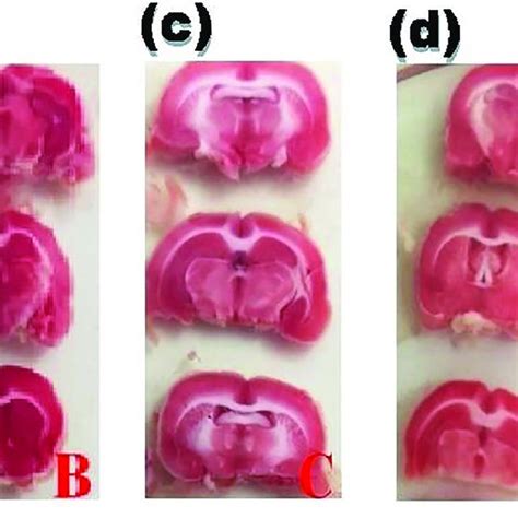 Ae Inhibits Morca With An Increase In The Percentage Of The Volume Of