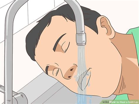 3 Ways To Heal A Split Lip Wikihow
