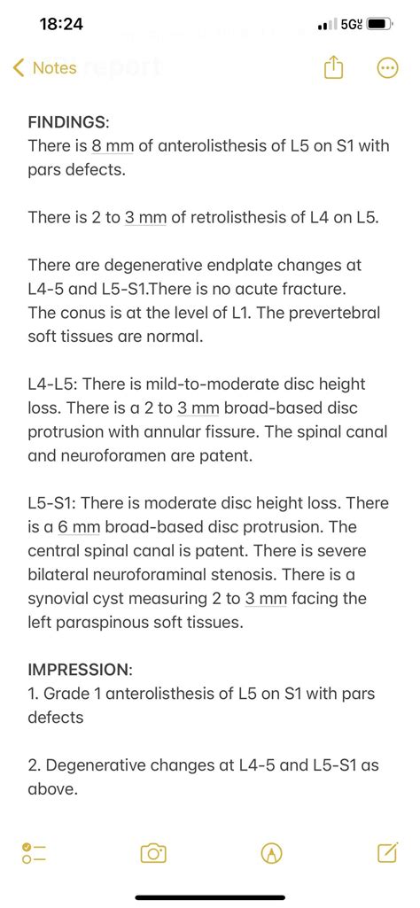 Debating Getting L4 S1 Fusion Surgery R Sciatica